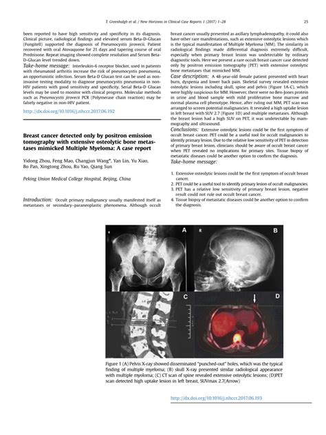 Pdf Breast Cancer Detected Only By Positron Emission Tomography With