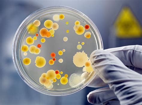 Home Exeter Clinical Laboratory International