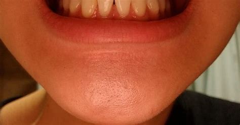 Teeth Album On Imgur