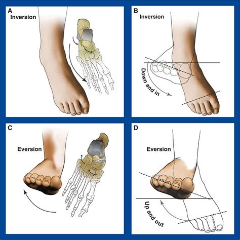 External Rotation Of Foot