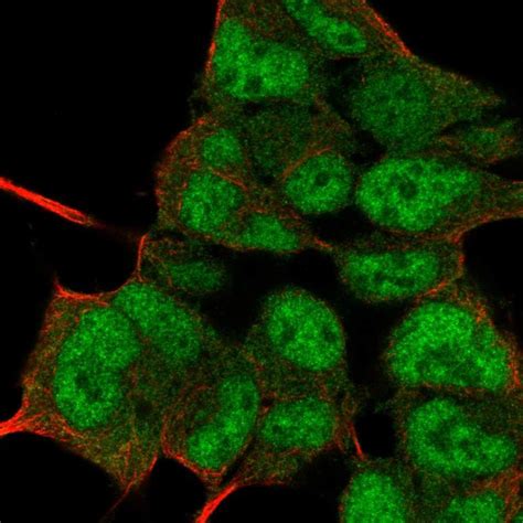 Rabbit Polyclonal Anti Pin1 Antibody Buy For Research Highly