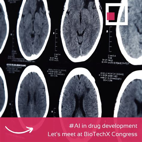 Graylight Imaging On Linkedin Brain Tumor Segmentation Challenges