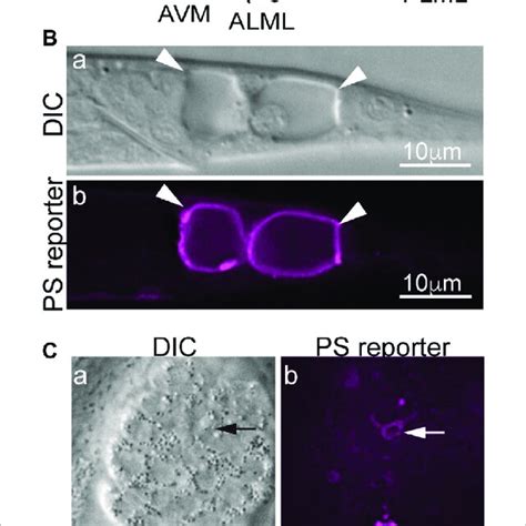 Ps Is Detected On The Surfaces Of Necrotic And Apoptotic Cells In