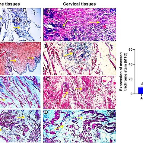 Photomicrographs Of Uterine And Cervical Specimens Showing Expression Download Scientific