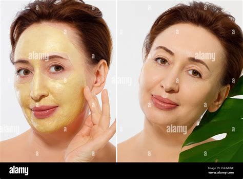 Middle Age Closeup Woman Face Before After Beauty Mask Treatment