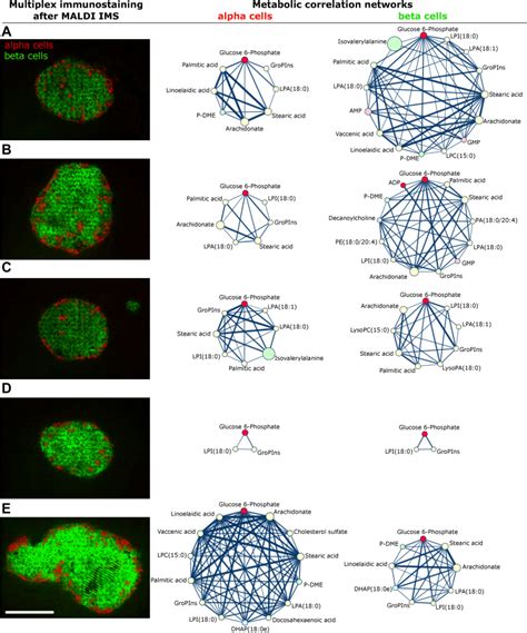 De Novo Discovery Of Metabolic Heterogeneity With Immunophenotype