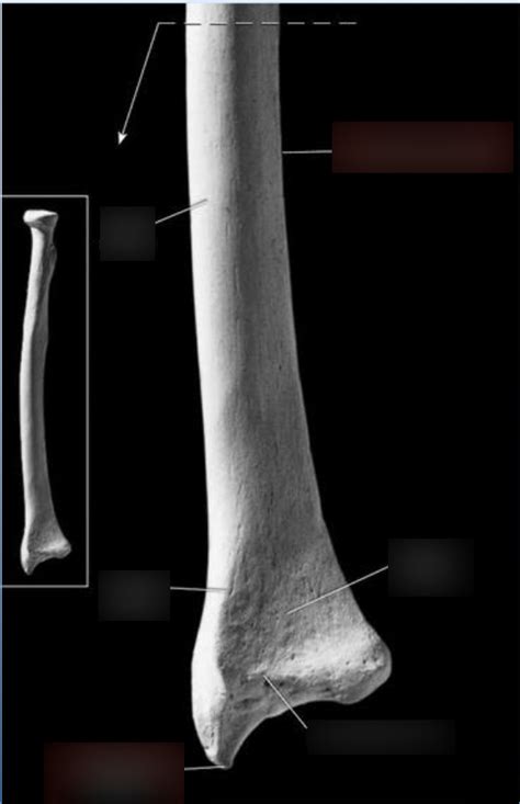 Distal Anterior Radius Labeling Diagram Quizlet