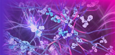 Resistant And Refractory Hypertension A Guideline Topline For Primary