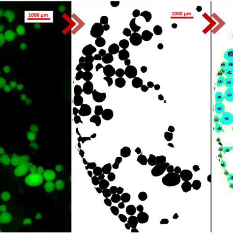 Esbl Confirmatory Test Double Disk Diffusion Method The Inhibition Download Scientific Diagram