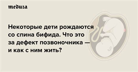 Некоторые дети рождаются со спина бифида Что это за дефект