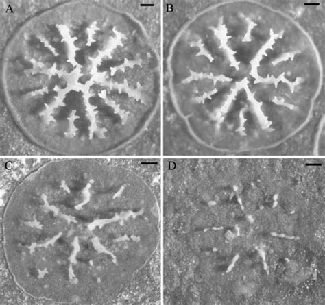 Ocean Acidification Negatively Impacts The Skeletal Growth Of
