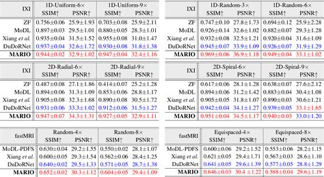 Table 1 From Deep Multi Modal Aggregation Network For Mr Image