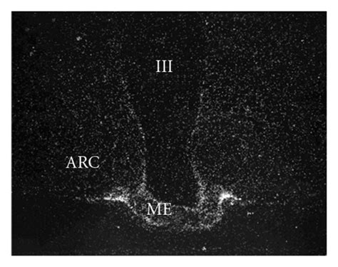 Infection Upregulates D2 Expression In Tanycytes Of The Rat Mediobasal