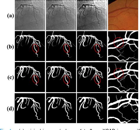 Figure 1 From Affinity Feature Strengthening For Accurate Complete And Robust Vessel