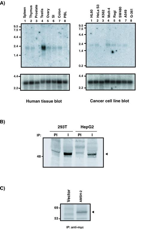 A Northern Blot Analysis Of Amsh 2 In Different Human Tissues And Cell