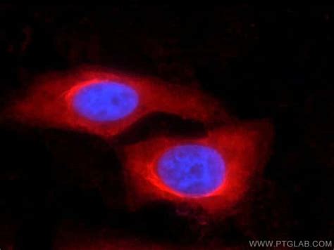 Iduronate 2 Sulfatase Mouse Anti Human Mouse Porcine Rat Clone