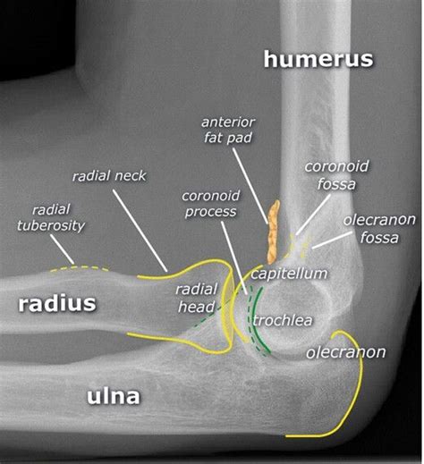 Weber Classification Of Ankle Fractures Artofit