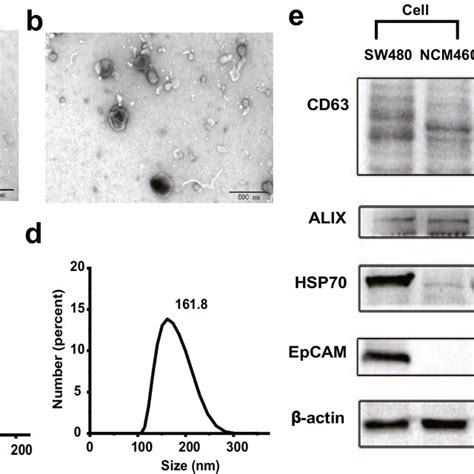 Characterization Of Exosomes A Tem Image Of Sw480 Cell Derived