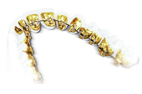 Lingual Braces Hidden Braces Manchester Orthodontics