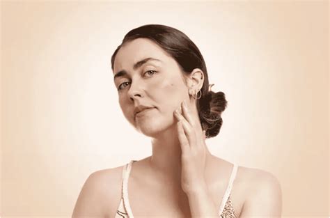 Urticaria Acuagénica Síntomas Diagnóstico Tratamiento Y Estrategias