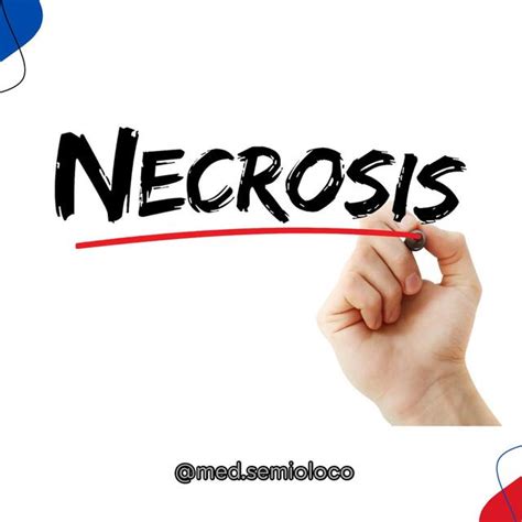 Necrosis Víctor Rodriguez Botero med semioloco uDocz
