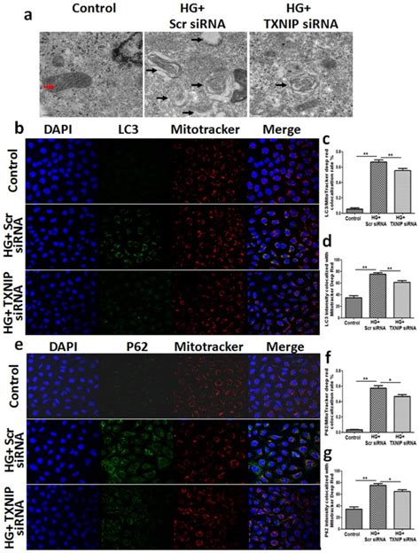 Thioredoxin Interacting Protein Txnip Regulates Tubular Autophagy And