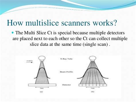 Difference Between 64 And 128 Slice Ct Captions Profile