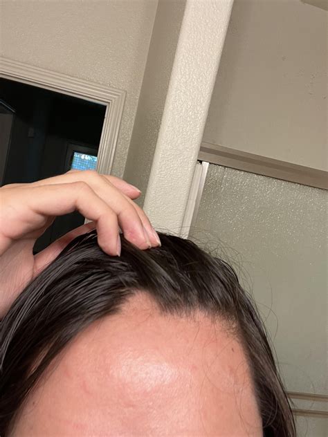 What Is This Bald Spot I Havent Got A Haircut In So Long Wtf R