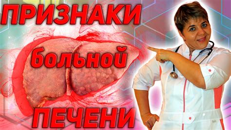 💊 Признаки, что ваша 🔴 ПЕЧЕНЬ НЕЗДОРОВА 🔥 - YouTube