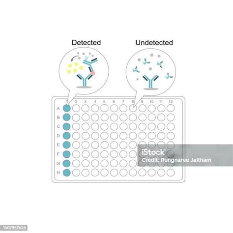 샌드위치 Elisa 기술을 이용한 단백질 검출의 결과 해석 검출 또는 미검출 검사 보기에 대한 스톡 벡터 아트 및 기타 이미지