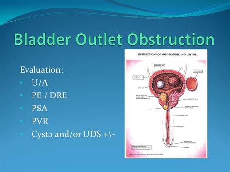 To Pee Or Not To Pee That Is The Question Ppt Download
