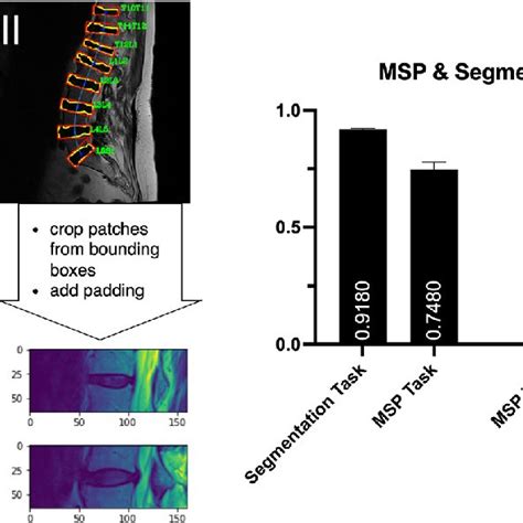 Processing Rate Of The Pipeline Showing The Ratio Between Mri Scans