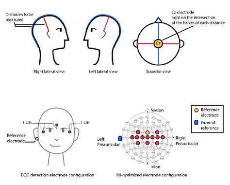Ground And Reference Electrode Eeg At Tamara Wickline Blog