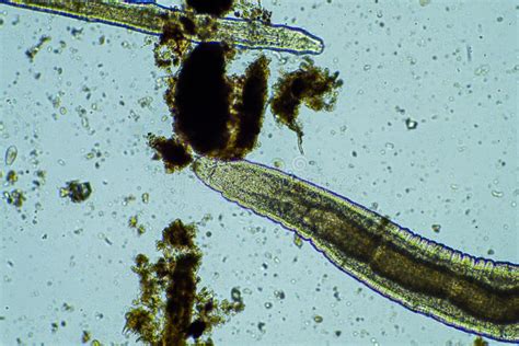 Human Parasite Gut Intestinal Infection Disease Stock Image Image Of
