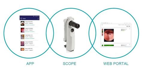 The Eva System Handheld Medical Device The Scope With End To End
