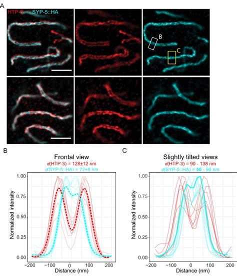 Super Resolution Microscopy Synaptonemal Complex Within