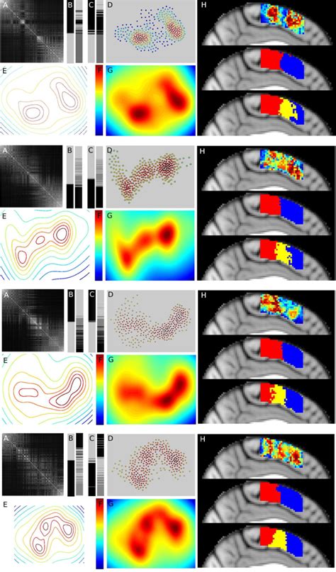 Figure A 1 From Heuristics For Connectivity Based Brain Parcellation Of Sma Pre Sma Through