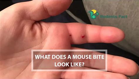 Mouse Bite Treatment 4 Dangers And Remedies Of Mouse Biting