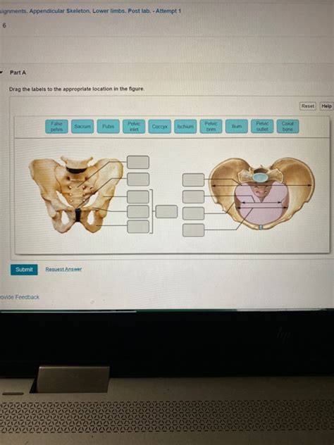 Solved Signments Appendicular Skeleton Lower Limbs Post