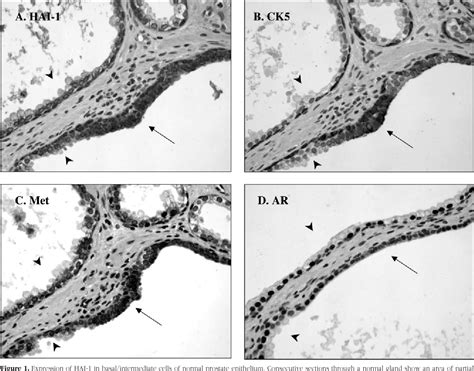 Figure 1 From Tumorigenesis And Neoplastic Progression Regulation Of