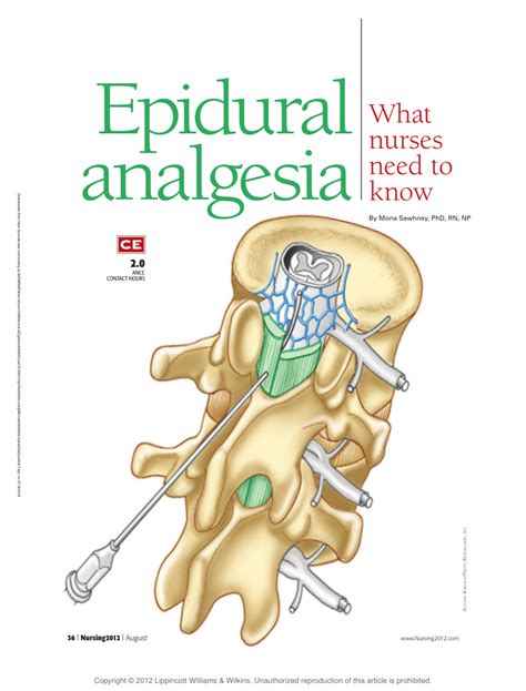 Epidural Analgesia Care Plan