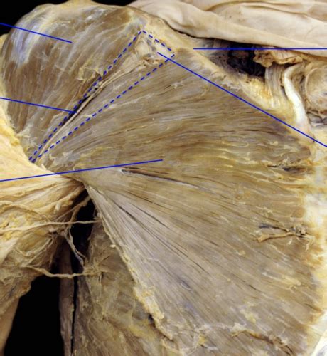 Lab 5 Brachial Plexus And Pectoral Region Cadaver Practical 2