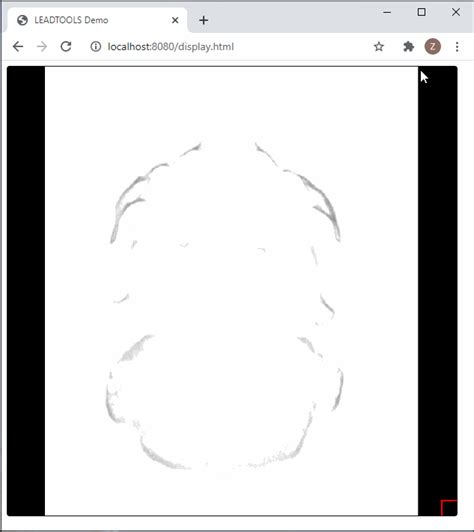 Tutorial View Dicom Images From Anywhere With Leadtools Html5 Medical