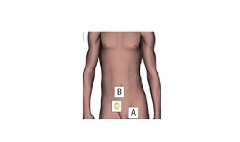 RN Adult Medical Surgical Online Practice 2019 A Flashcards Quizlet