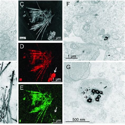 TEM Images Of Cells Exposed To Ag NPs TEM Images A B F And G STEM Download Scientific