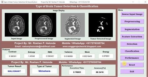 Matlab Code For Types Of Brain Tumor Detection Full Project Source Code IEEE Based Projects