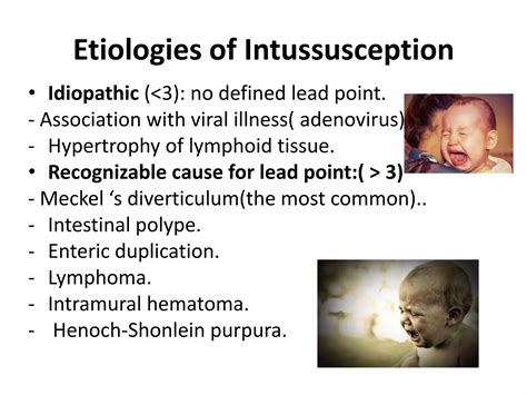 Intussusception Pptx Digestive Disorders Diseases And Conditions