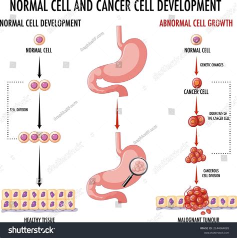 Diagram Showing Normal Cancer Cell Illustration Stock Vector Royalty Free