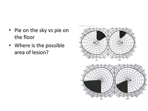 Visual Field PPTX Eye And Vision Conditions Diseases And Conditions