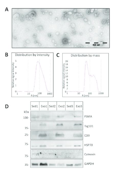 Characterization Of Urine Exosomes Urine Extracellular Vesicles Download Scientific Diagram